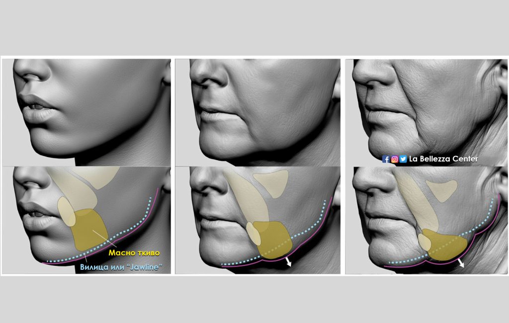 LOWER FACE FILLERS: Контурирање на долна третина на лицето - La ...